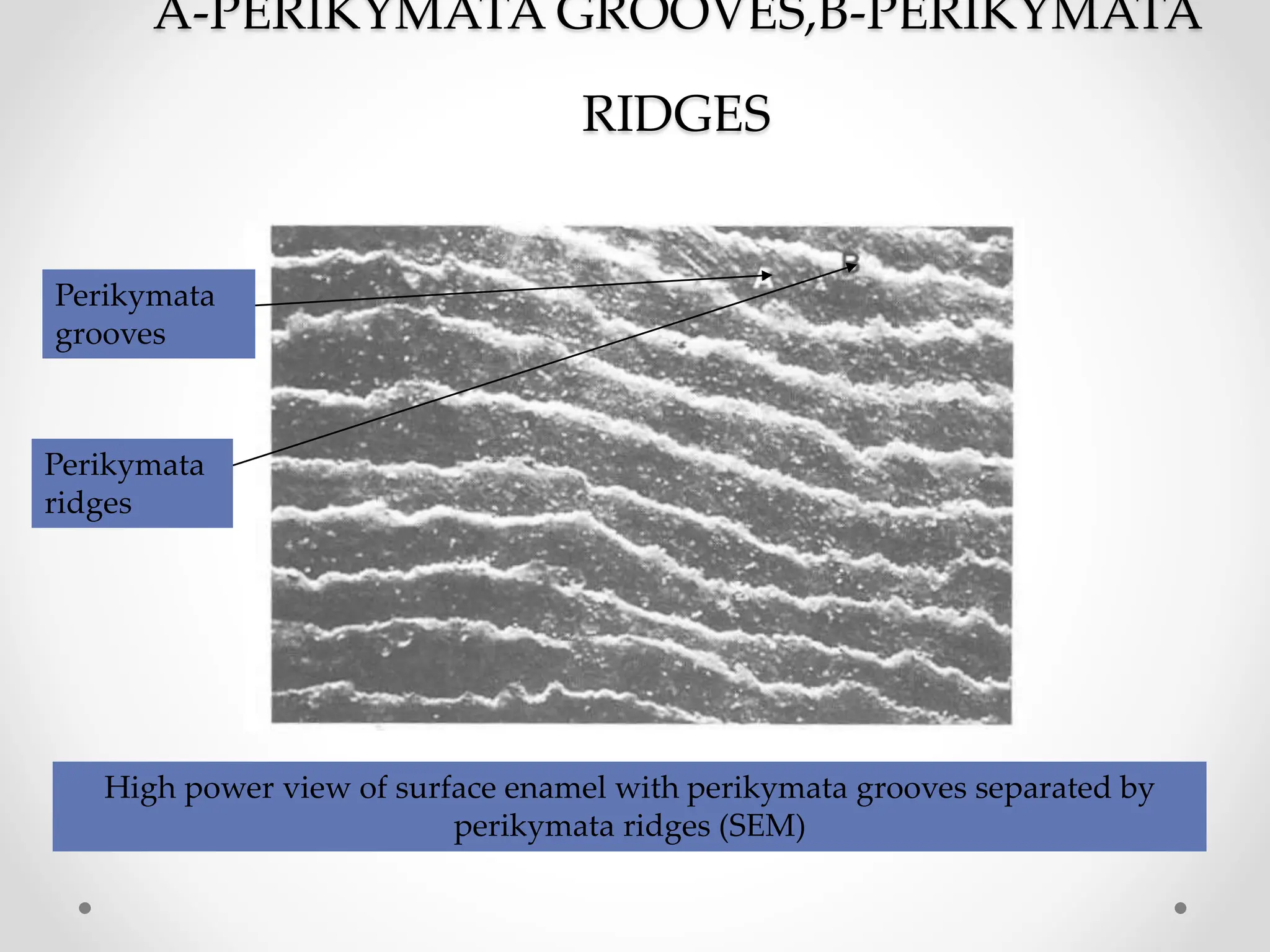 HYPOCALCIFIED STRUTURES OF ENAMEL.pptx