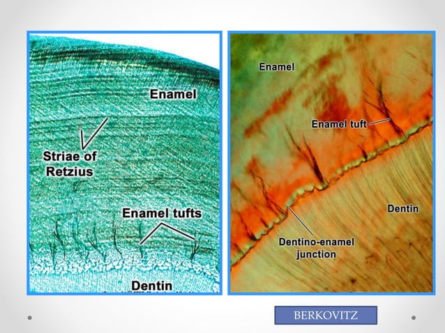 HYPOCALCIFIED STRUTURES OF ENAMEL.pptx