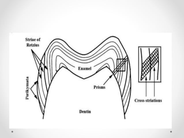 HYPOCALCIFIED STRUTURES OF ENAMEL.pptx