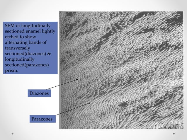 HYPOCALCIFIED STRUTURES OF ENAMEL.pptx