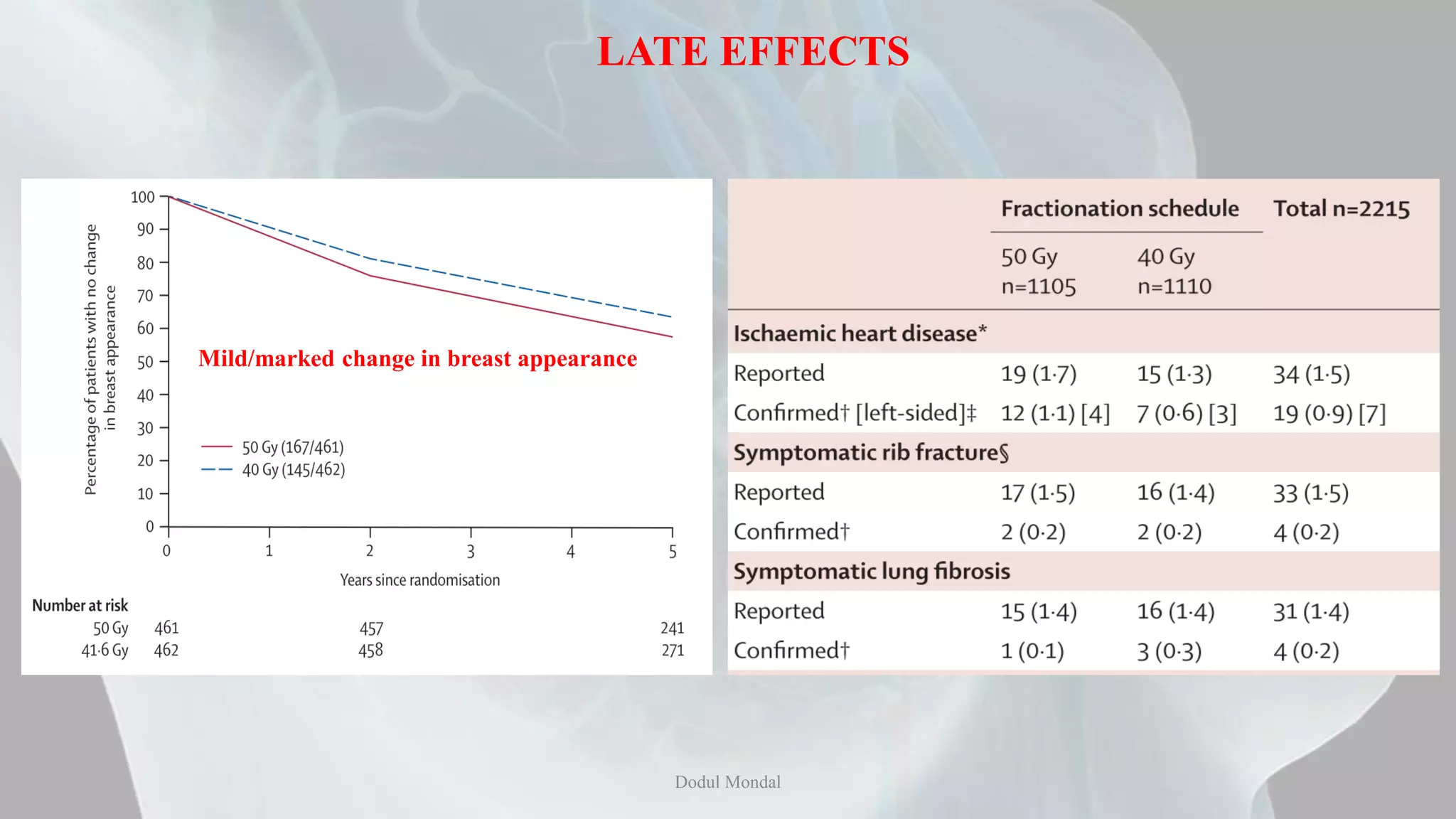 Hypofractionation in breast cancer | PDF