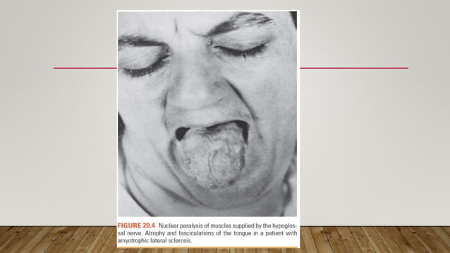 Hypoglossal nerve | PPTX | Ear, Nose and Throat Conditions | Diseases ...