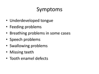 Hypoglossia hypodactylia | PPT