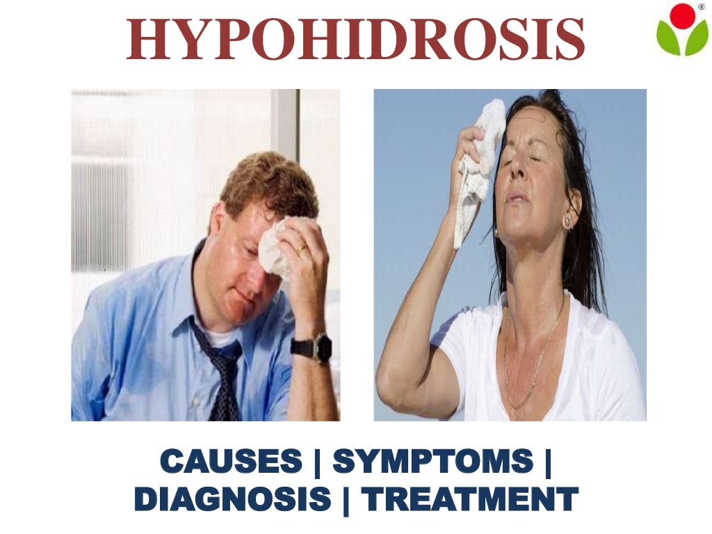 Hypohidrosis: Causes, sign, symptoms, diagnosis and treatment
