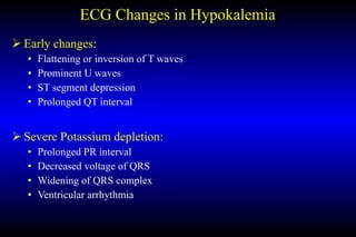 ECG: Hypokalemia | PPT
