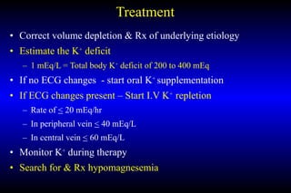 ECG: Hypokalemia | PPT