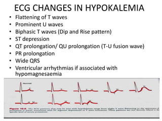 Hypokalemia - Approach and Management | PPTX