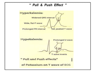 approach causes management of HYPOKALEMIA.pptx