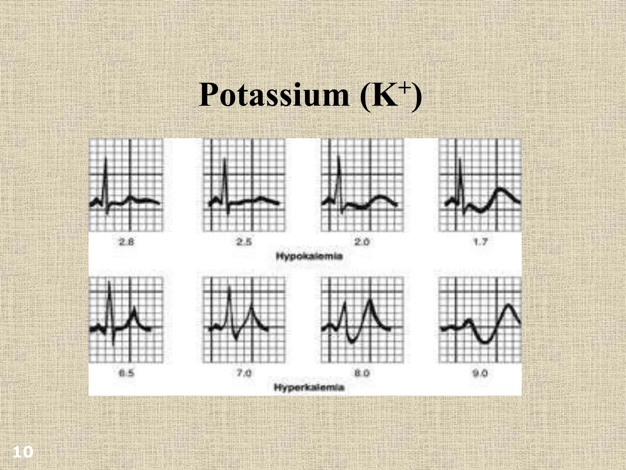 Management of hypokalemia.ppt(electrolyte imbALANE) | PPT