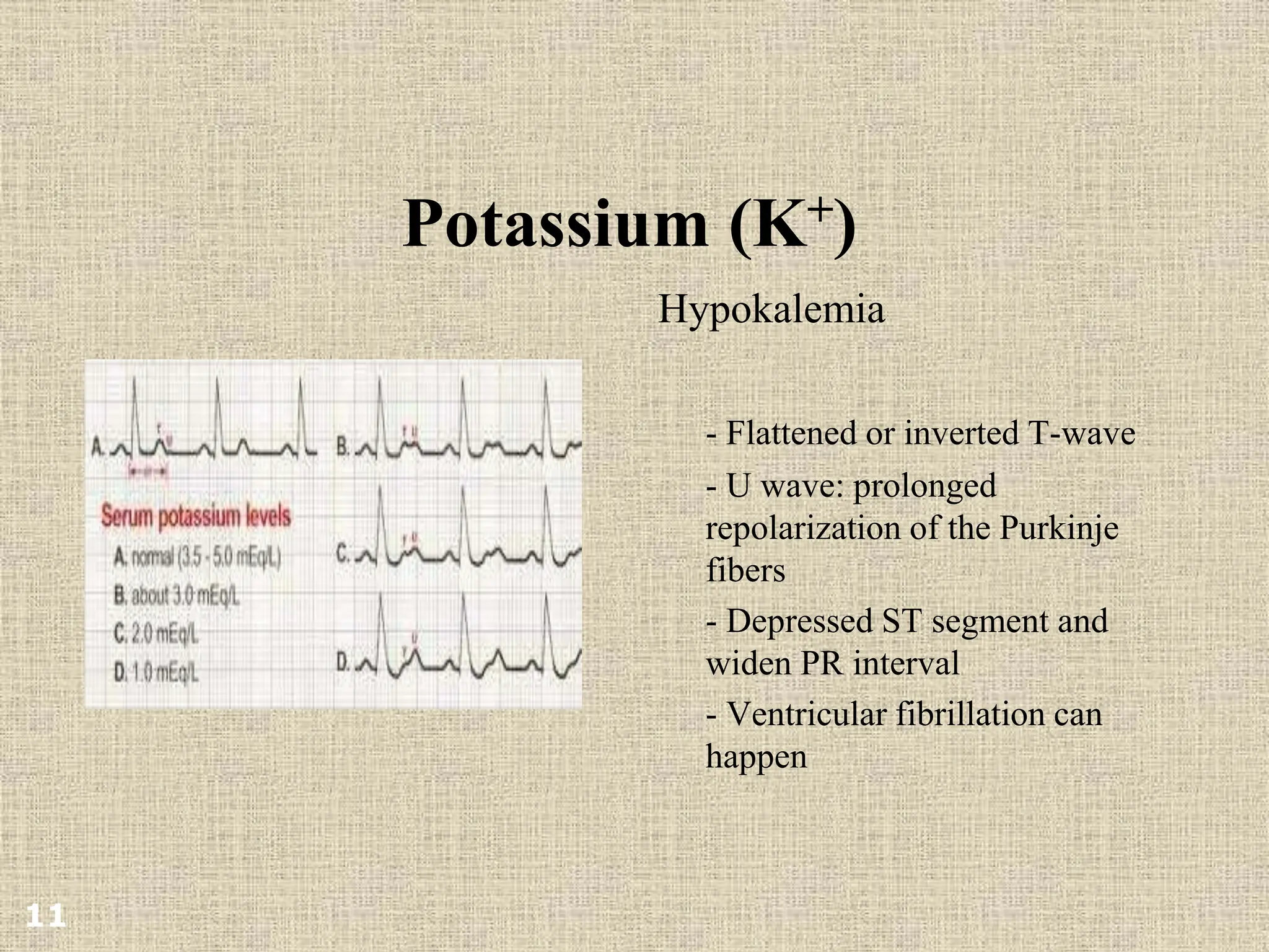 Management of hypokalemia.ppt(electrolyte imbALANE) | PPT