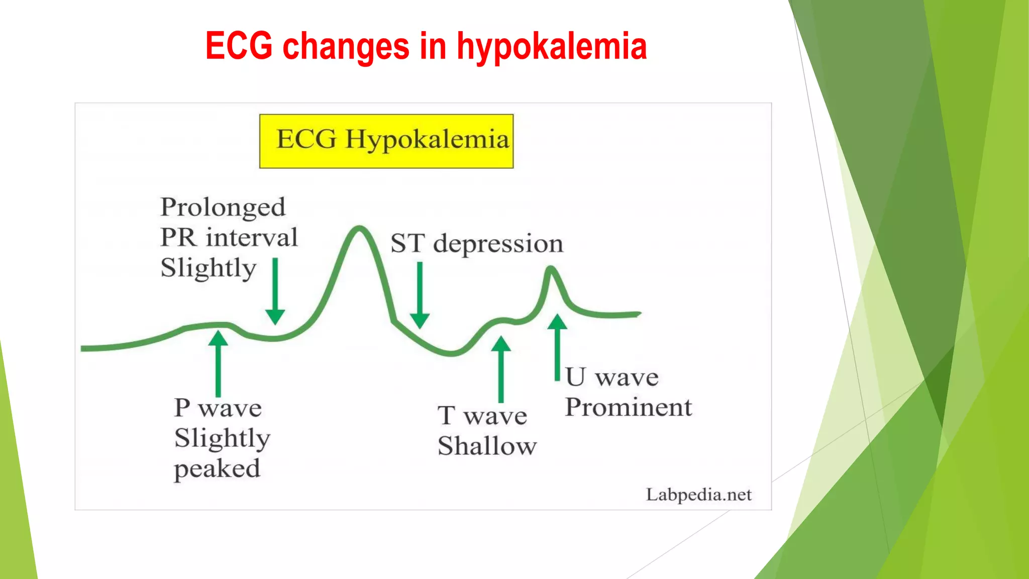Hypokalemia bysadek alrokh | PDF