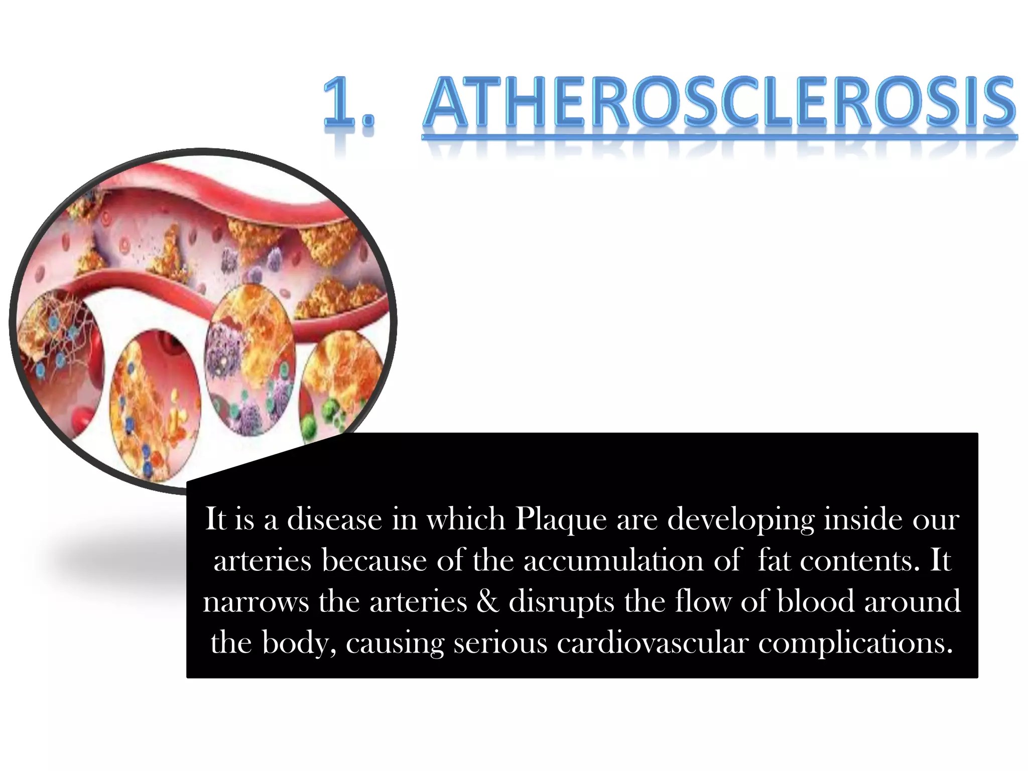 Hypo-kinetic Diseases | PDF