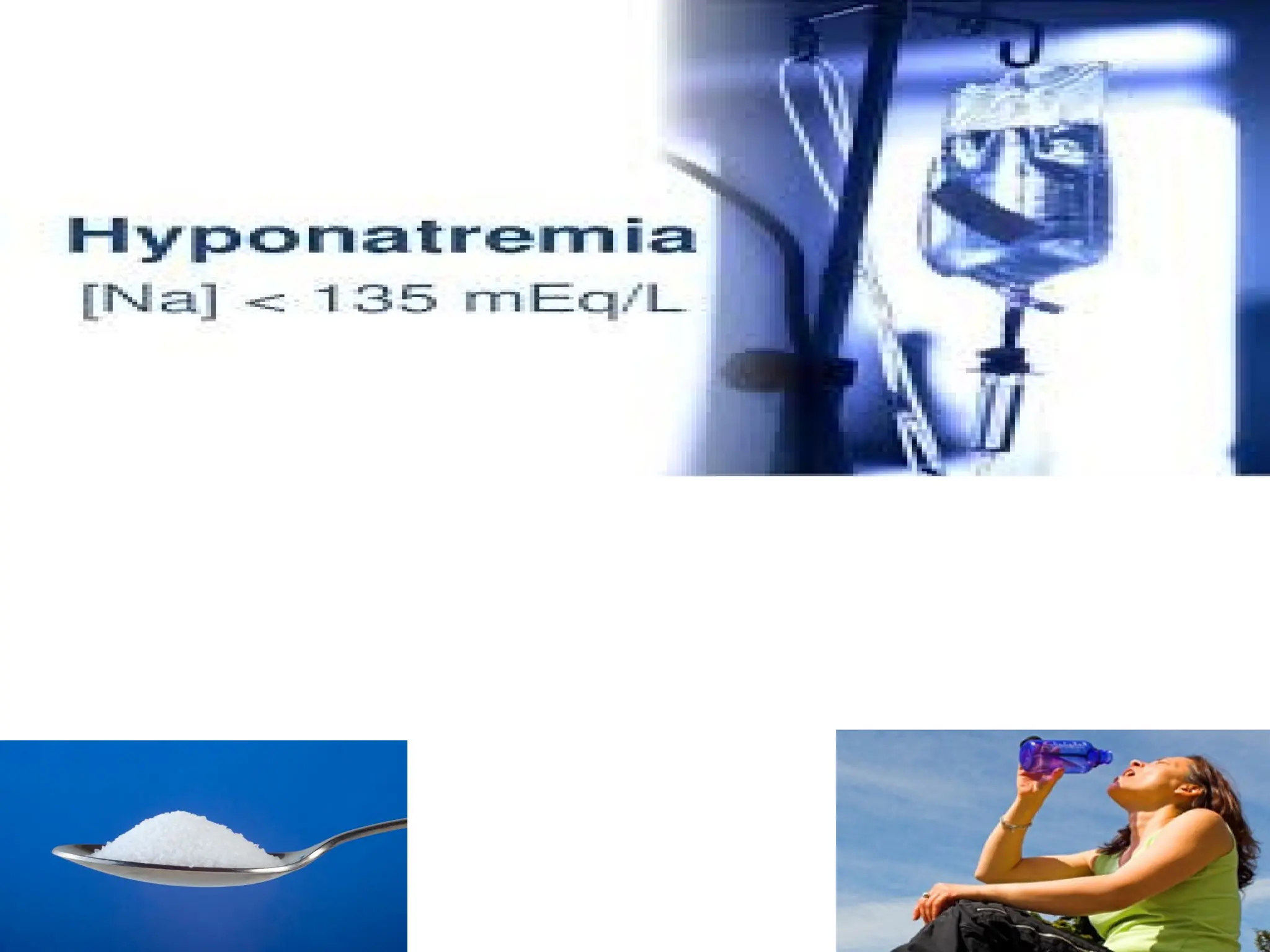 hyponatremia management in medical intensive care unit | PPT