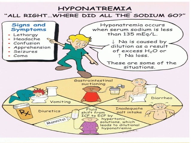 hyponatremia management in medical intensive care unit | PPT