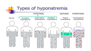 Hyponatremia | PPT