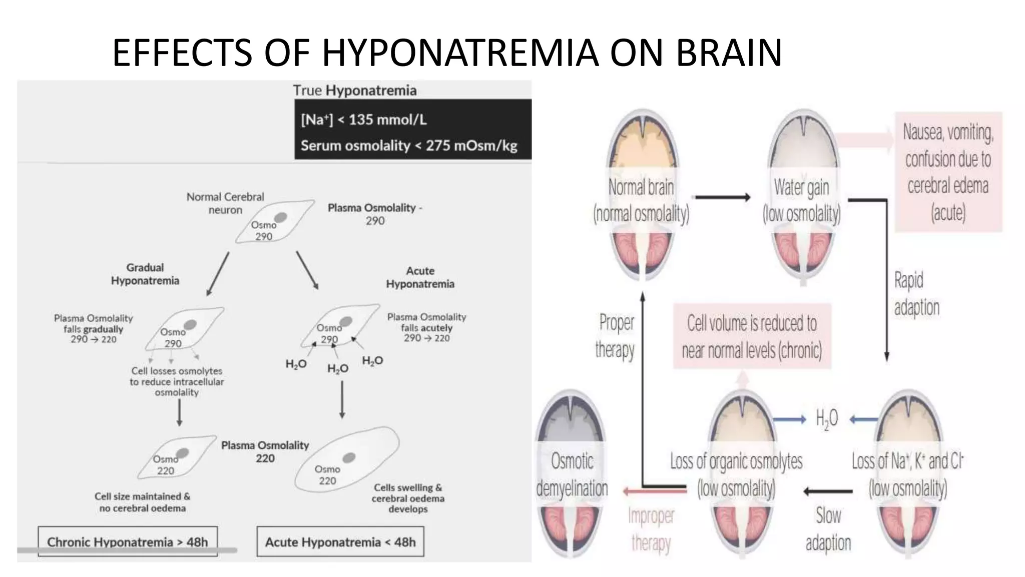 hyponatremia.pptx