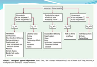 Hyponatremia (1) | PPTX