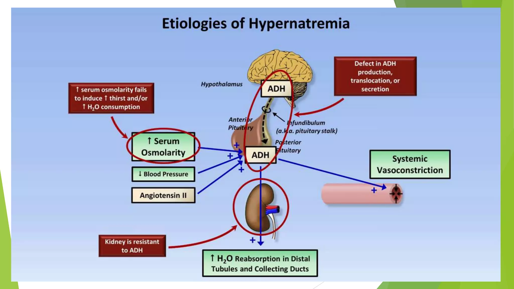 Hyponatremia and hypernatremia | PPTX