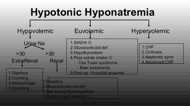 Hyponatremia by akram