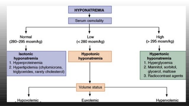 Hyponatremia by akram