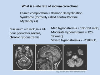 Hyponatremia_coteaching.veryveryfinal.pptx