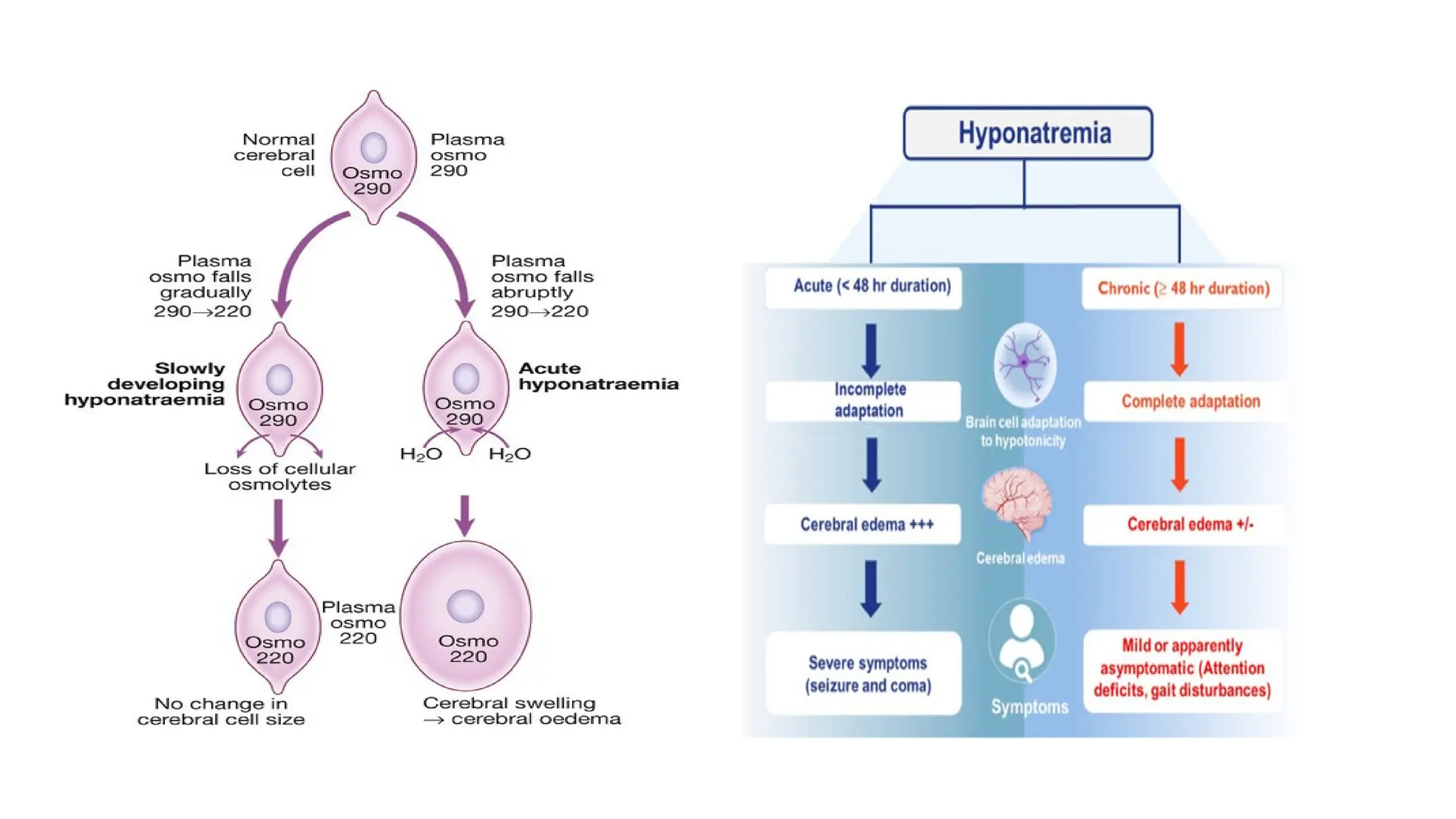 HYPONATREMIA and hypernatremia ppt (2).pptx