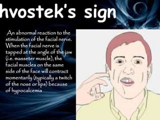 Hypoparathyroidisim | PPTX