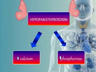Hypoparathyroidisim | PPTX
