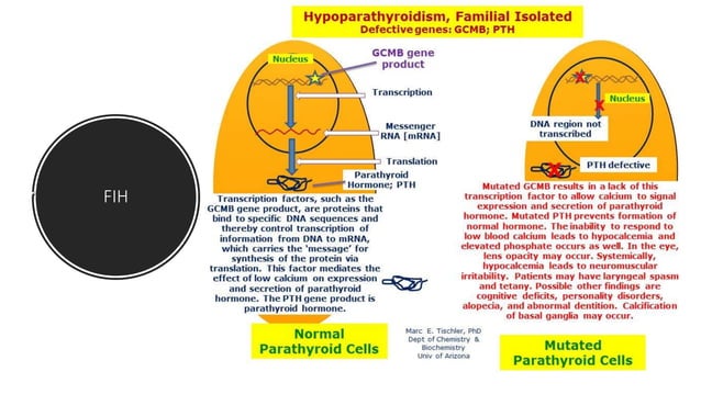 Hypoparathyroidism A Case Based Approach Pptx Thyroid Disorders Endocrine And Metabolic