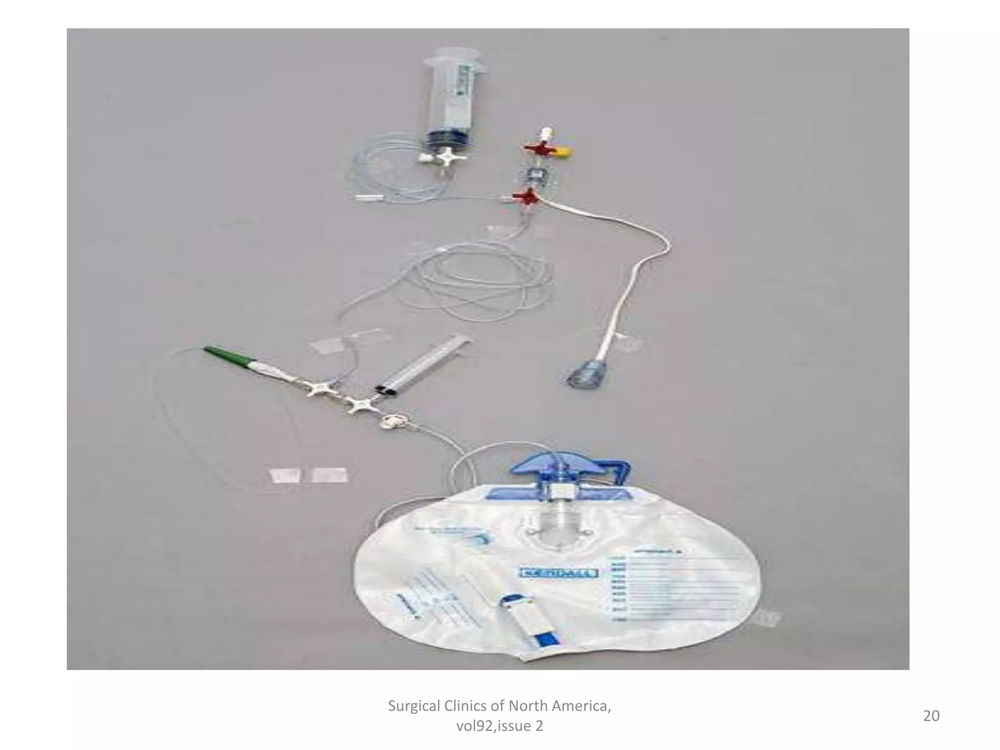 Hypoperfusion, shock states, and abdominal compartment | PPT | Free ...