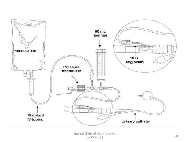 Hypoperfusion, shock states, and abdominal compartment | PPT | Free ...