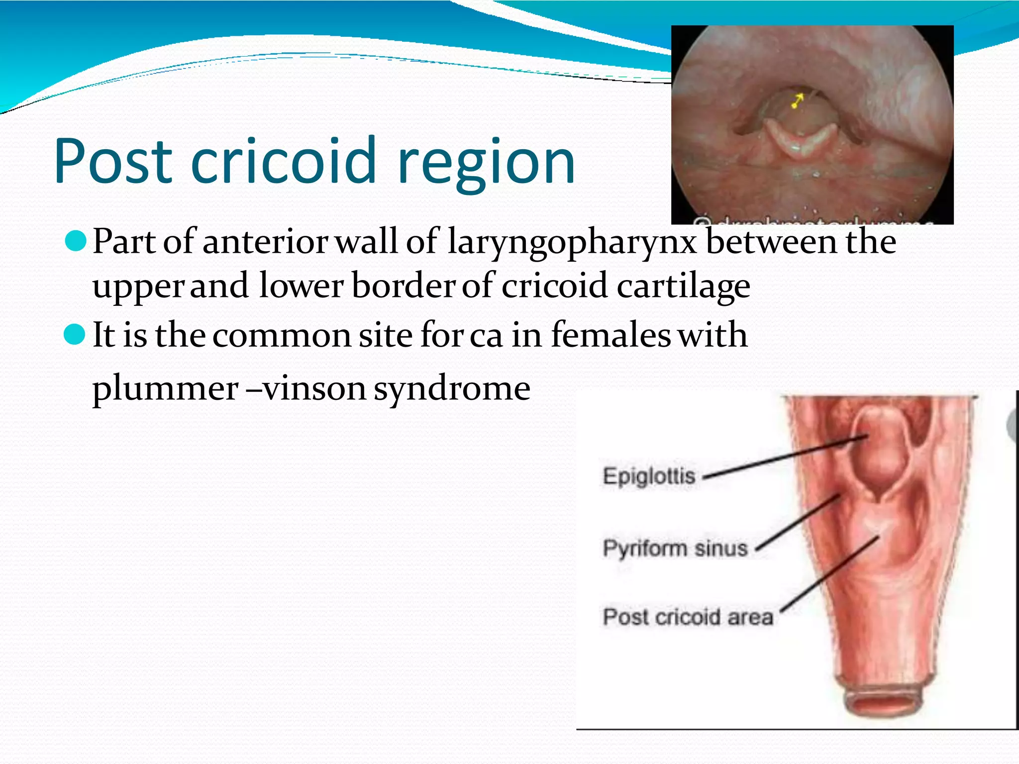 hypopharynxanatomy-210108085428.pptx