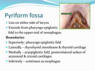 Pyriform Sinus Diagram