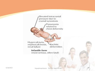 Hypophosphatasia | PPT