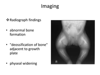 HYPOPHOSPHATASIA.pptx