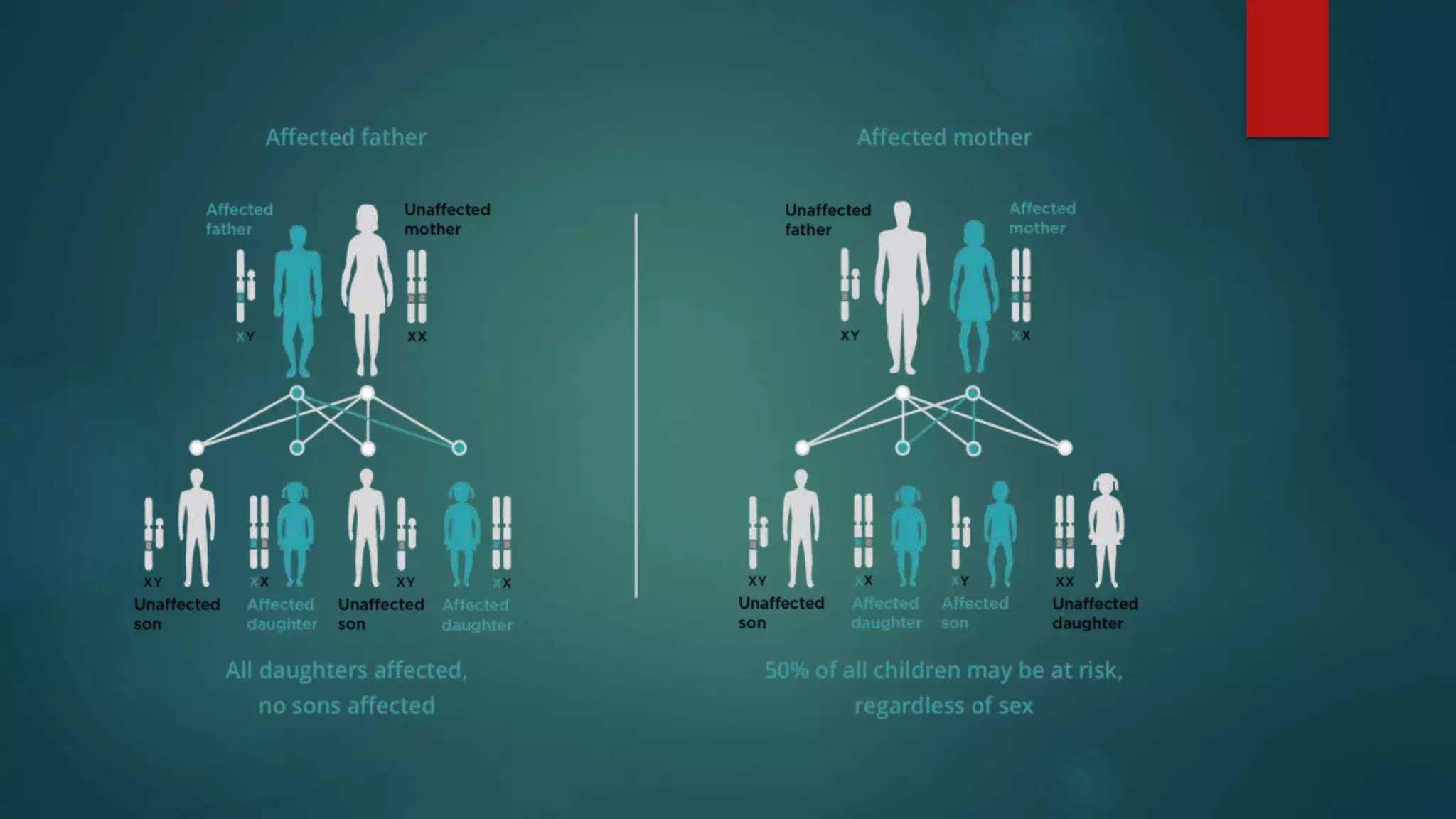 Hypophosphatemic rickets | PPTX