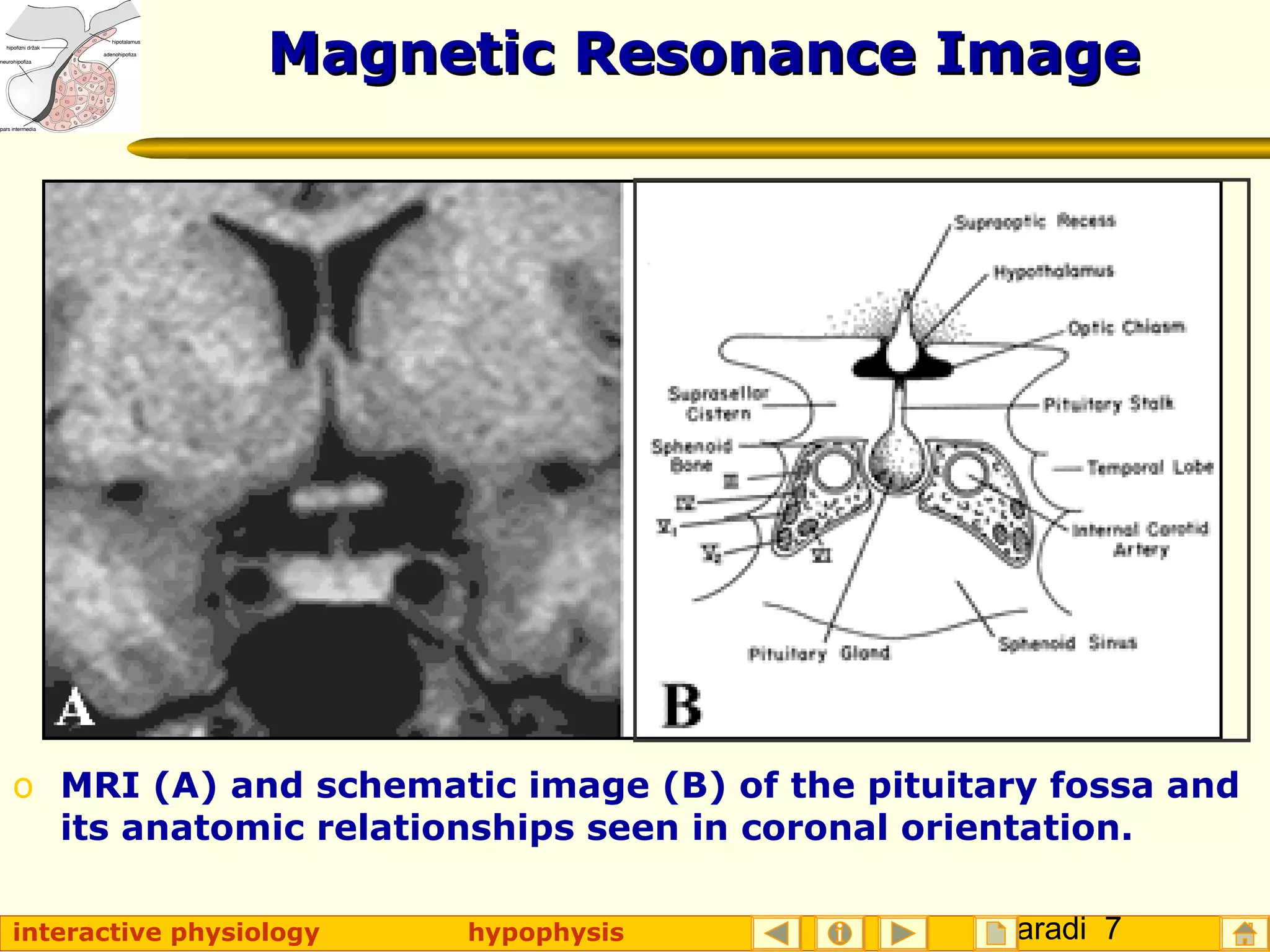 Hypophysis (Pituitary Gland) | PPT