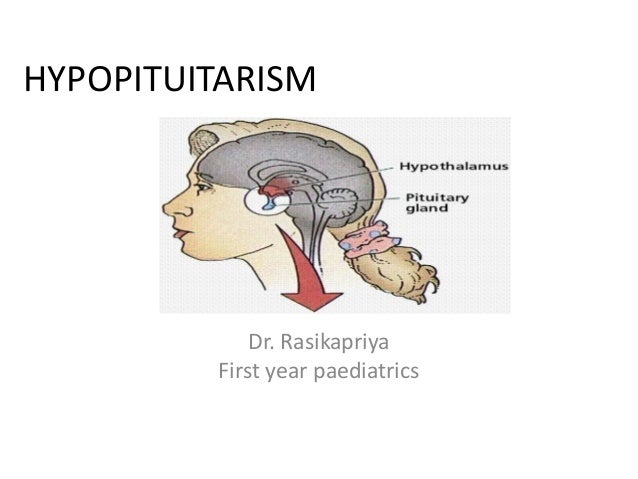 Hypopituitarism