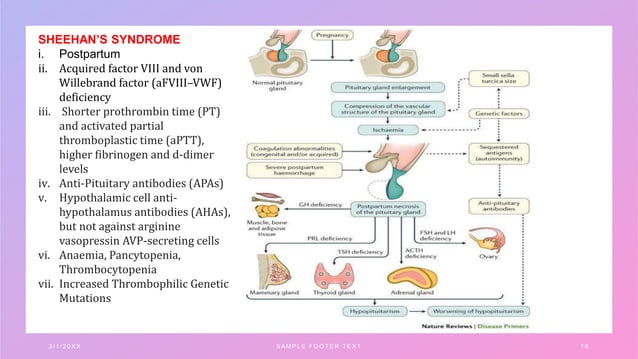 SHEEHAN SYNDROME AND PAN HYPOPITUITARISM - ENDOCRINOLOGY .pptx