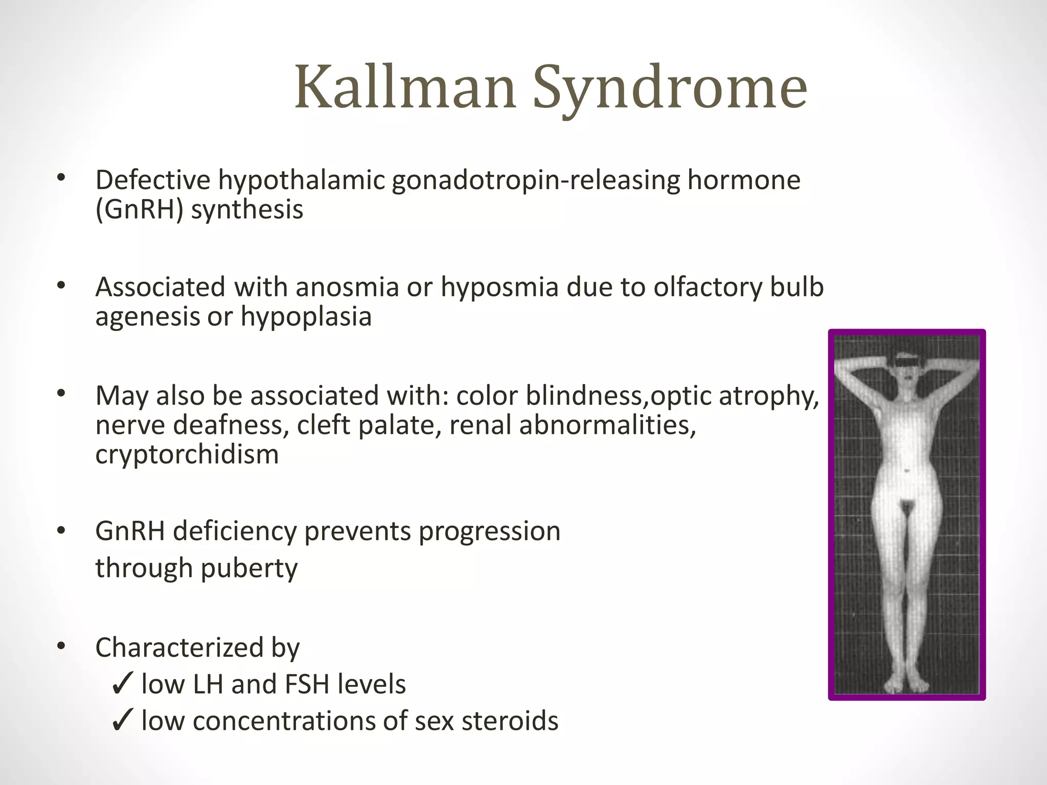 HYPOPITUITARISM.pptx