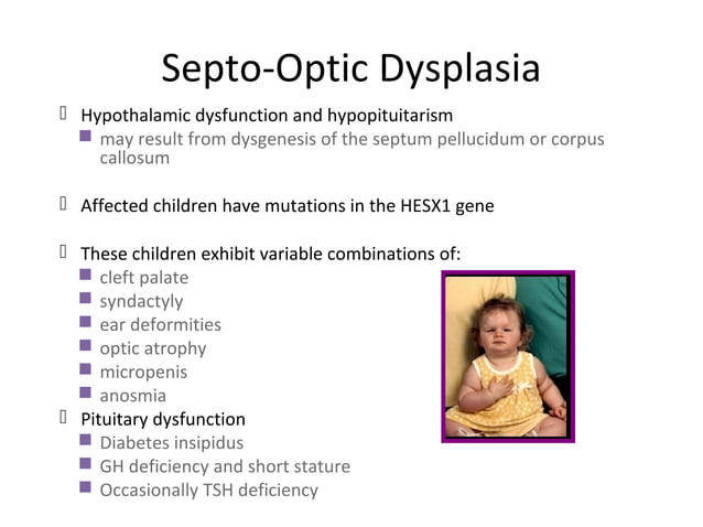 Hypopituitarism diagnosis and management (1) | PPT | Hormonal Disorders ...