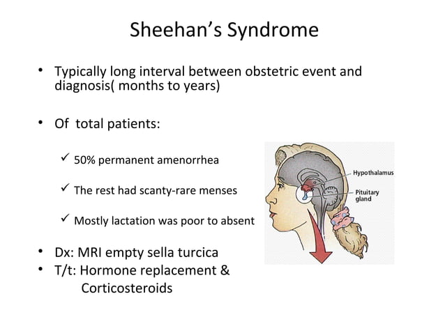 Hypopituitarism diagnosis and management (1) | PPT | Hormonal Disorders ...