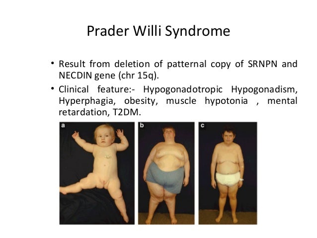 Hypopituitarism Diagnosis And Management 1