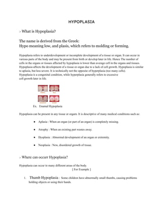 HYPOPLASIA BY SUMIT NAMDEV.pdf | Eye and Vision Conditions | Diseases ...