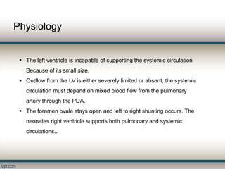 Hypoplastic left heart syndrome Surgical management | PPTX