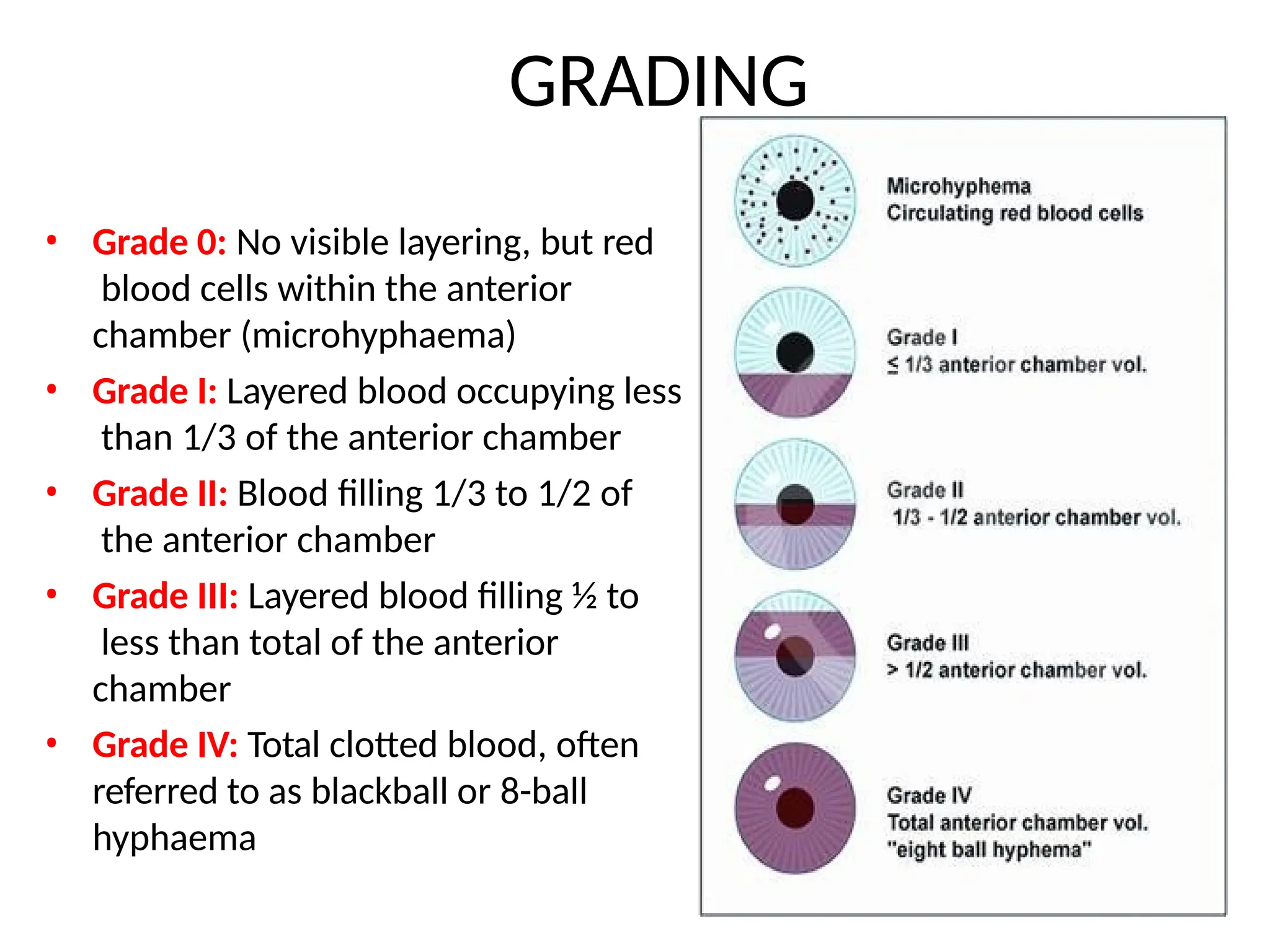 hypopyon vs ................hyphema.pptx