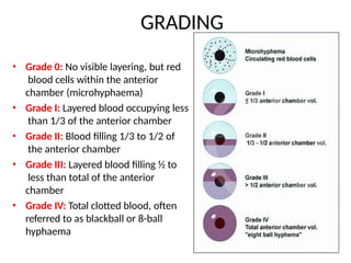 hypopyon vs ................hyphema.pptx