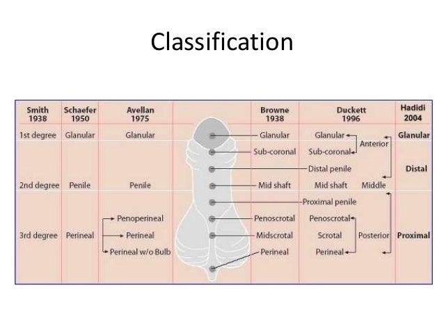 Hypospadias. An introduction.