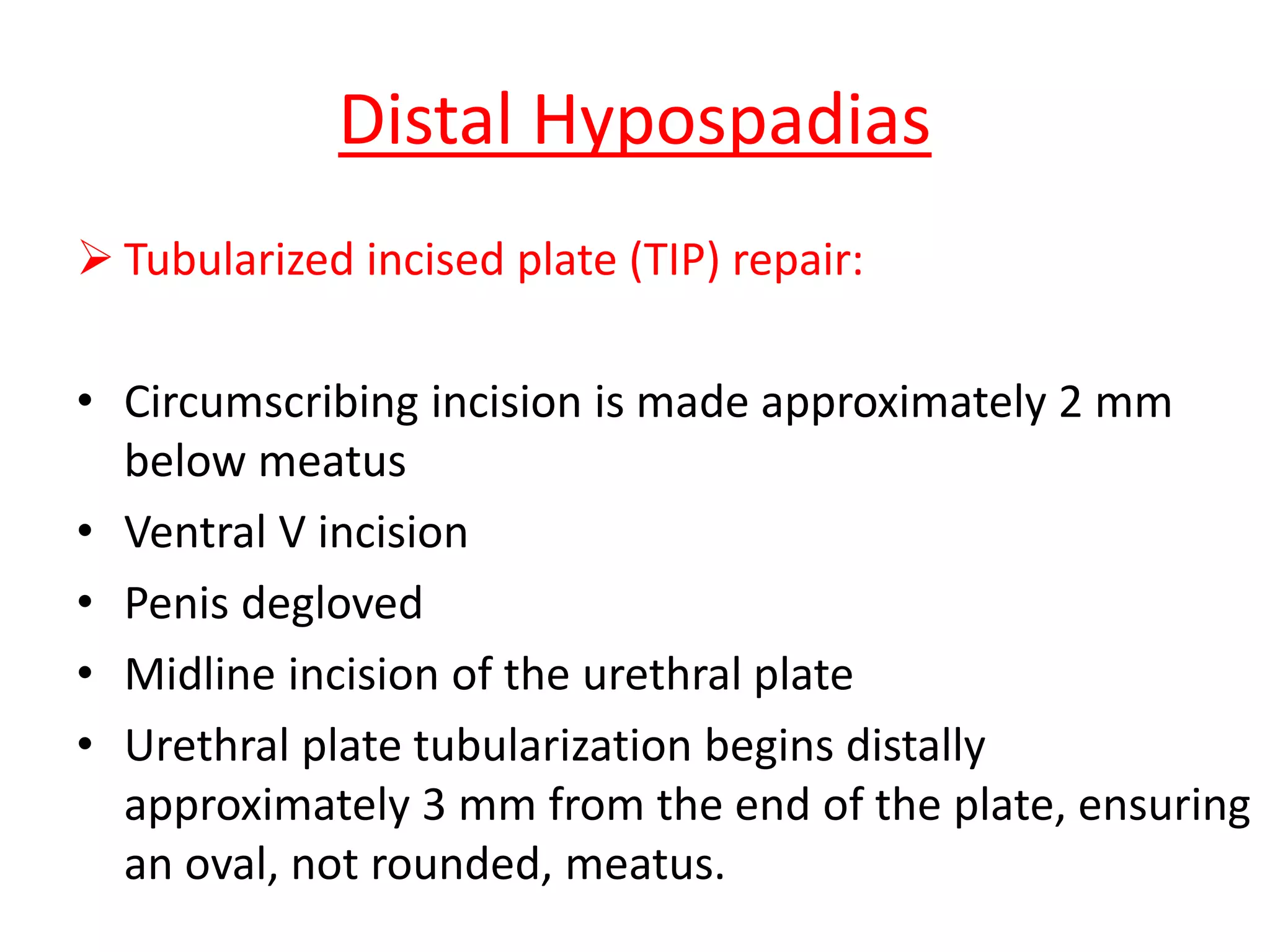 Hypospadias | PPTX