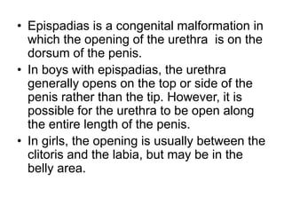 Hypospadias | PPTX